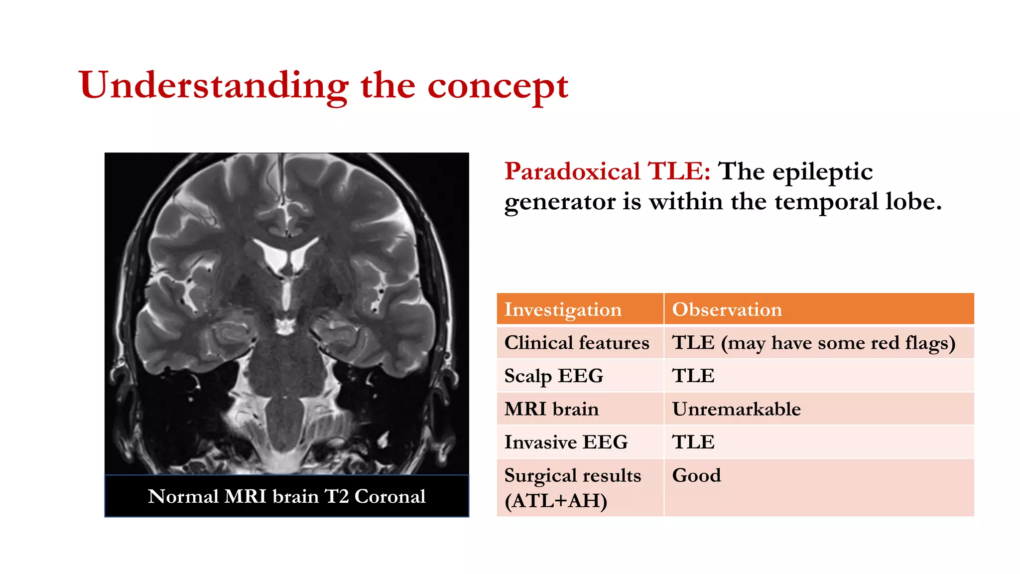 Temporal plus syndrome | PPTX