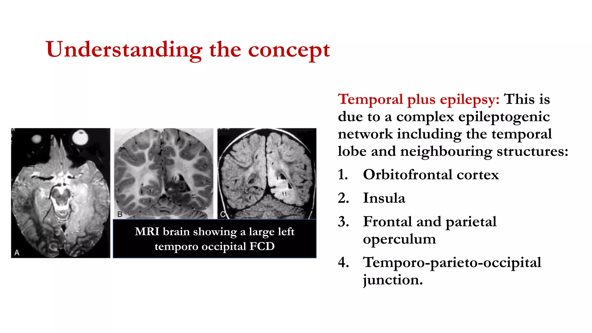 Temporal plus syndrome | PPTX