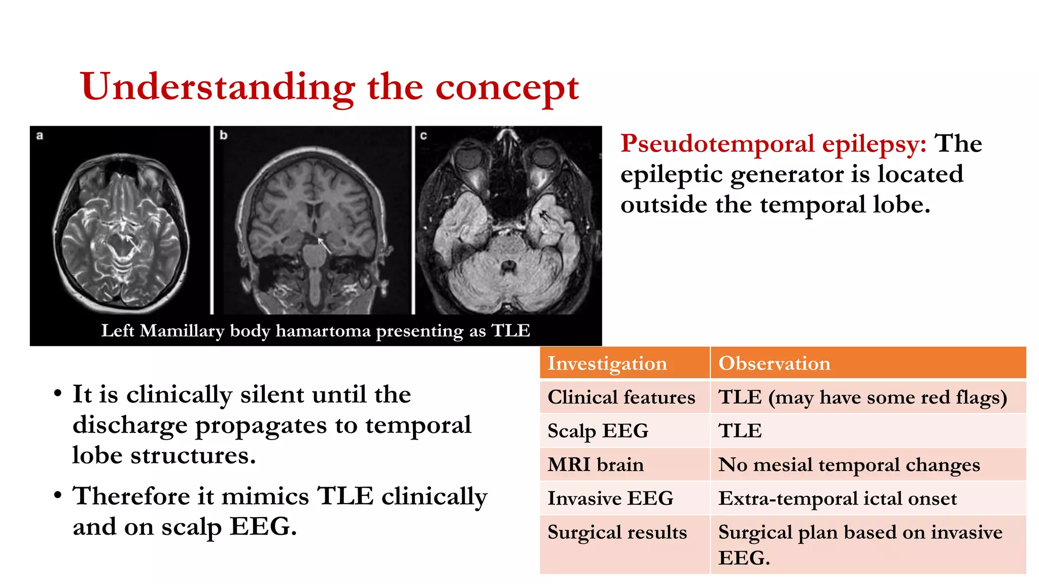 Temporal plus syndrome | PPTX