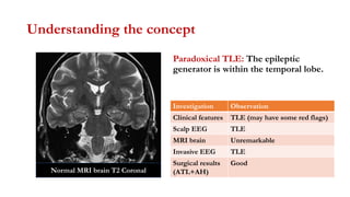 Temporal plus syndrome | PPTX