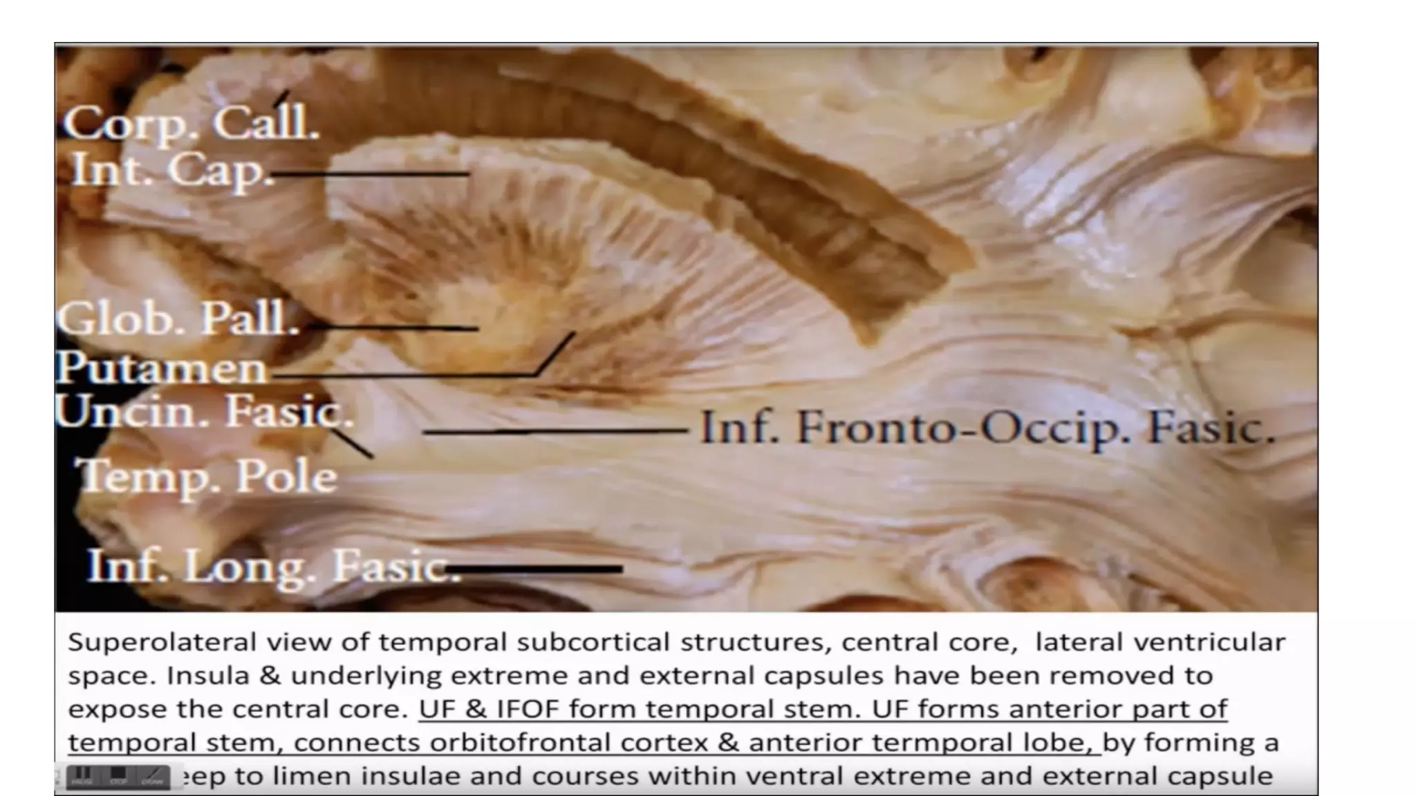 Temporal stem anatomy | PDF