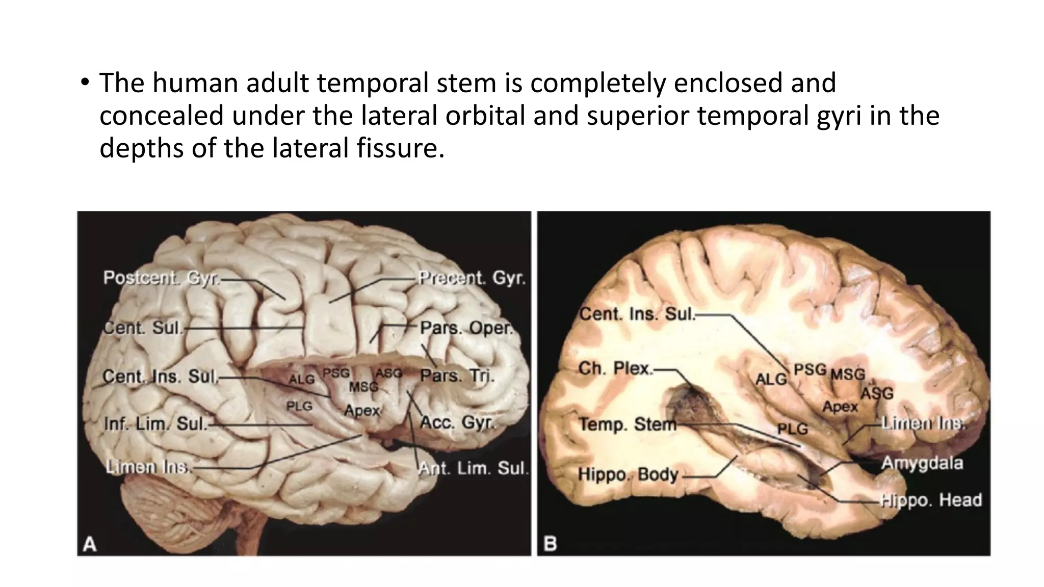 Temporal stem anatomy | PDF