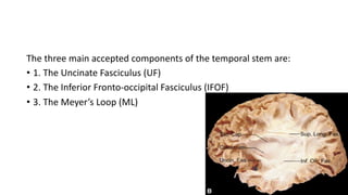 Temporal stem anatomy | PPT