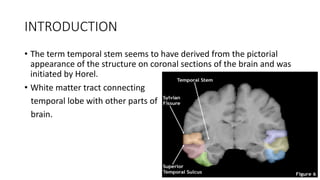 Temporal stem anatomy | PPT