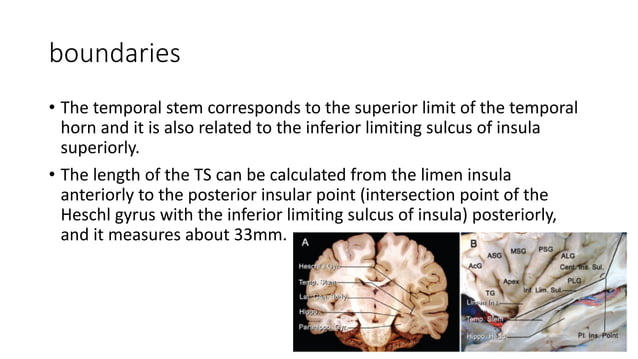 Temporal stem anatomy | PPT