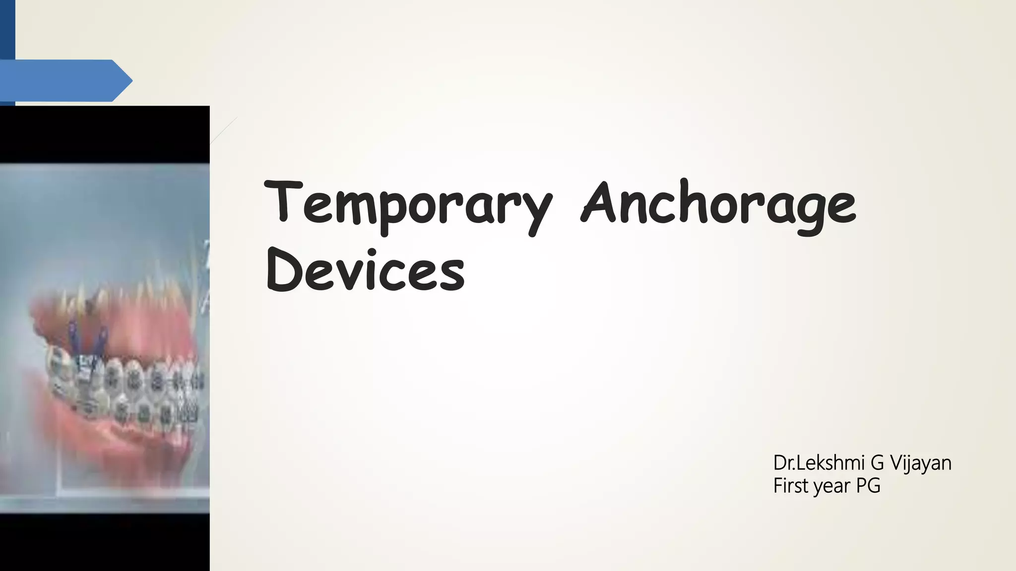 Temporary anchorage devices | PPTX