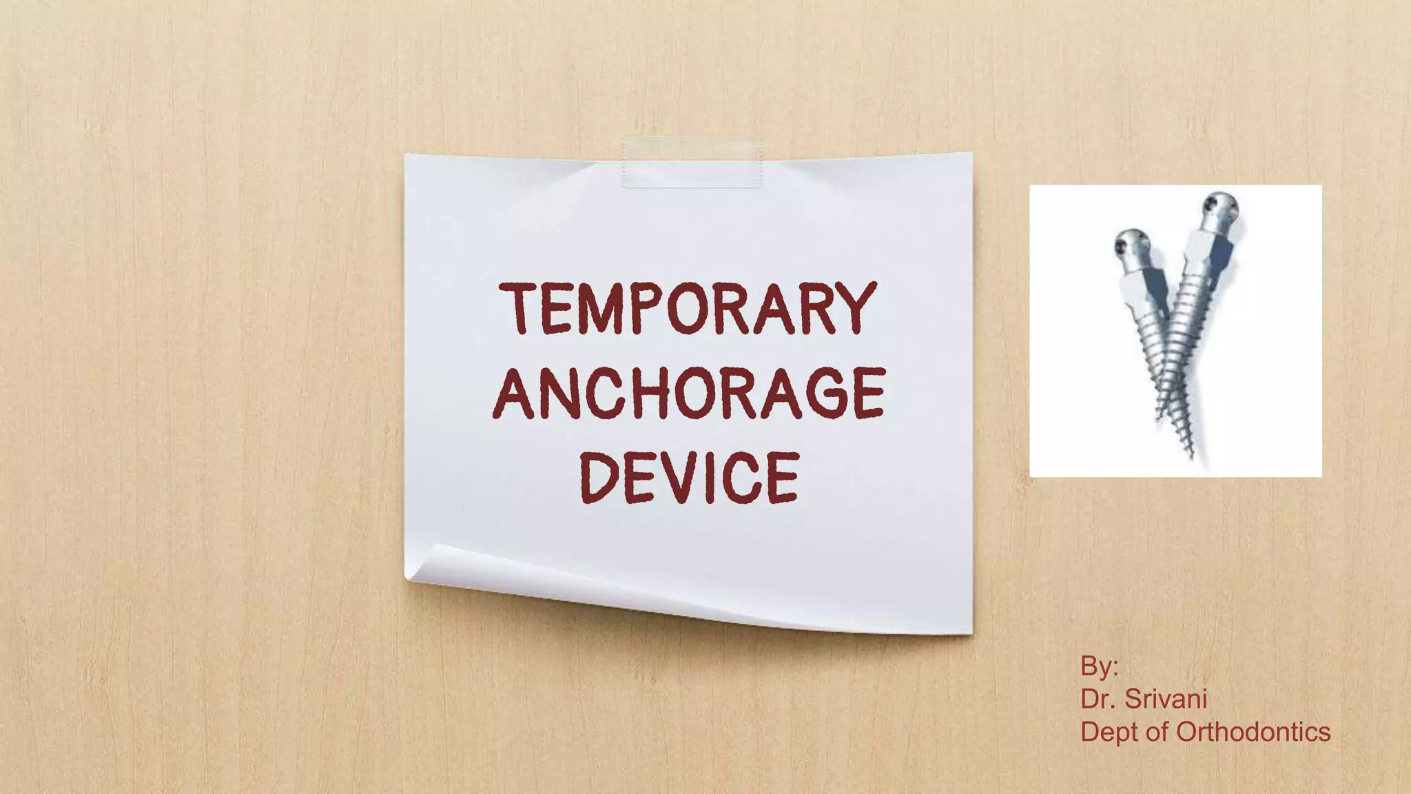 Temporary Anchorage Device (TAD's) | PPTX