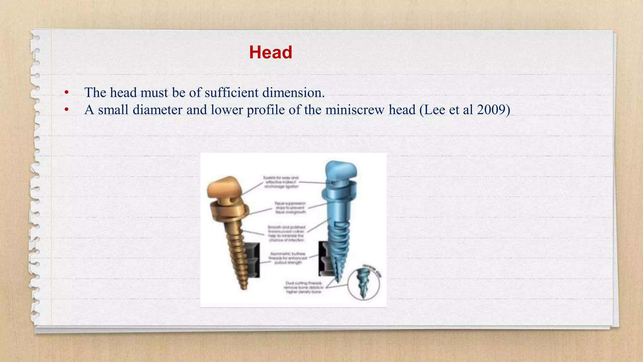 Temporary Anchorage Device (TAD's) | PPTX