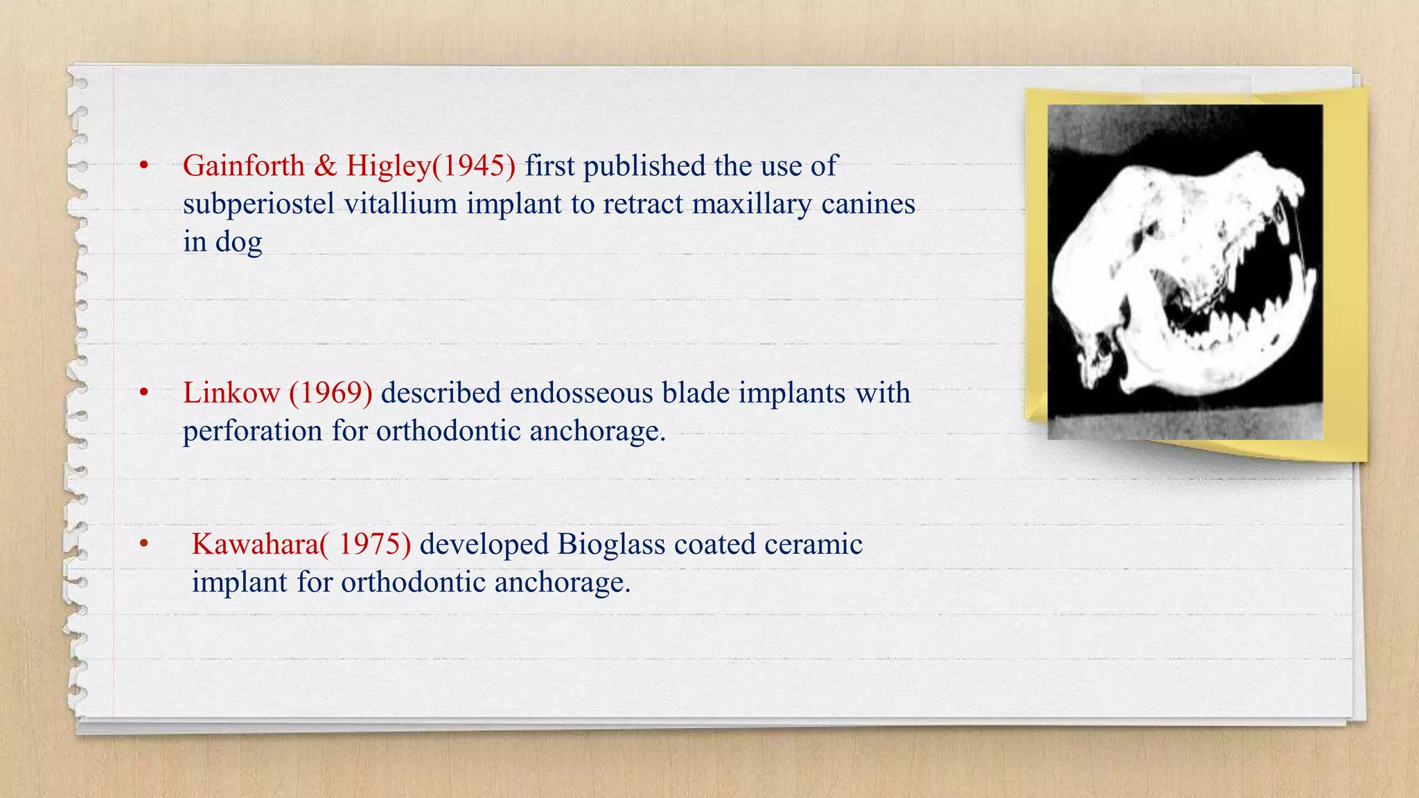 Temporary Anchorage Device (TAD's) | PPTX