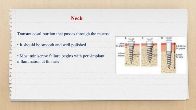 Temporary Anchorage Device (TAD's) | PPTX