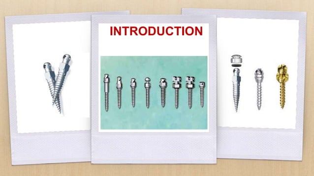 Temporary Anchorage Device (TAD's) | PPTX