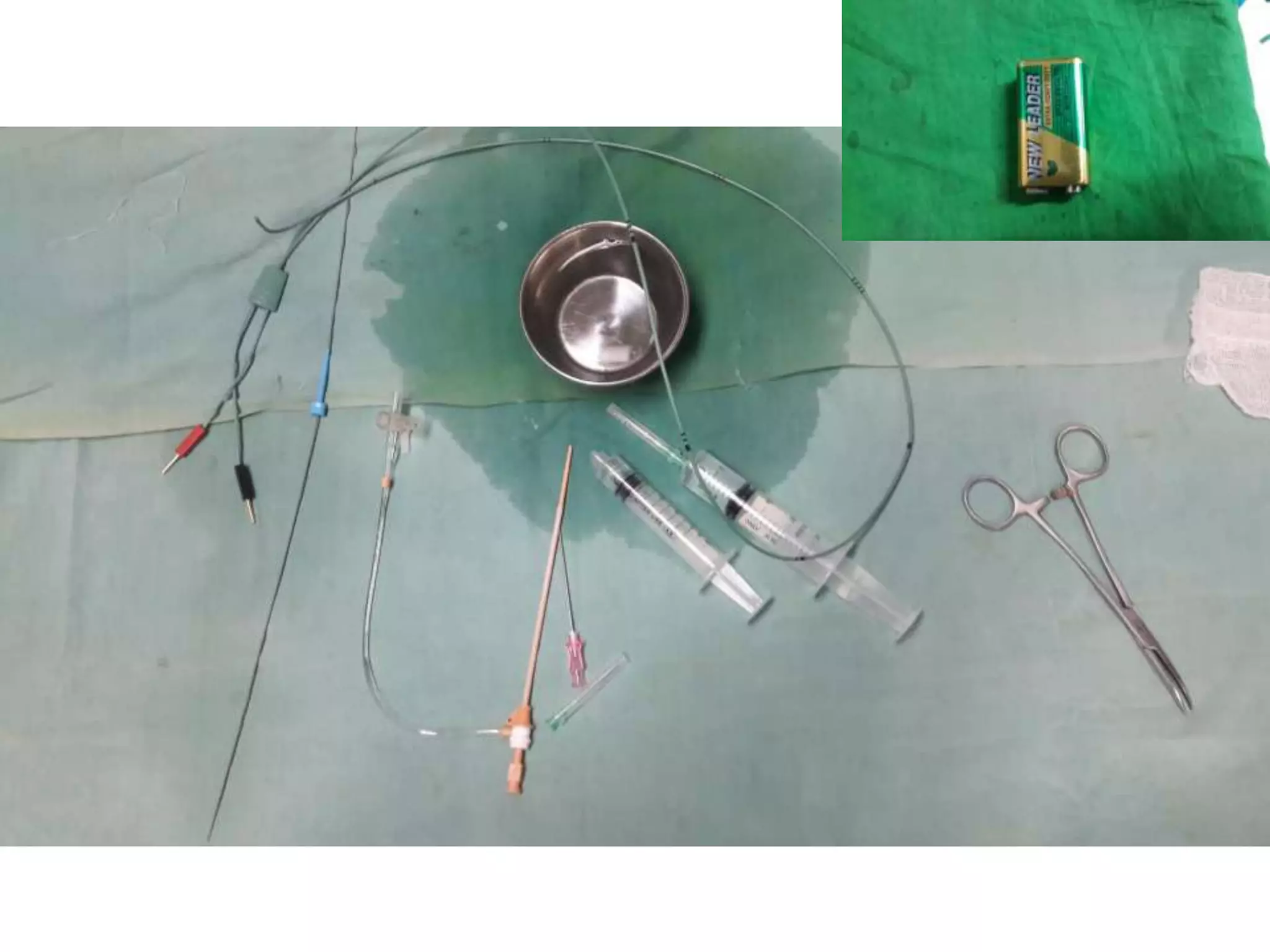Temporary cardiac pacing | PPTX