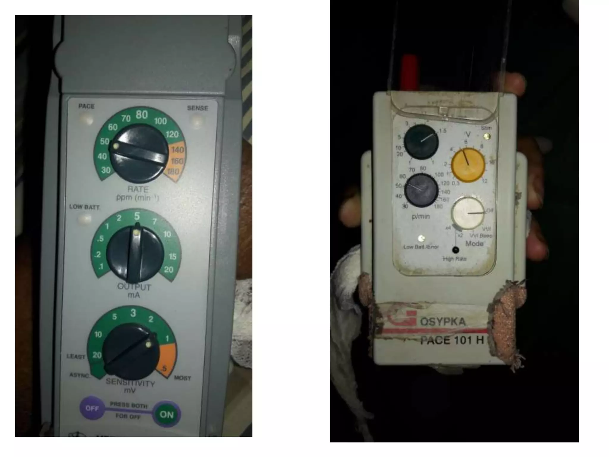 Temporary cardiac pacing | PPTX