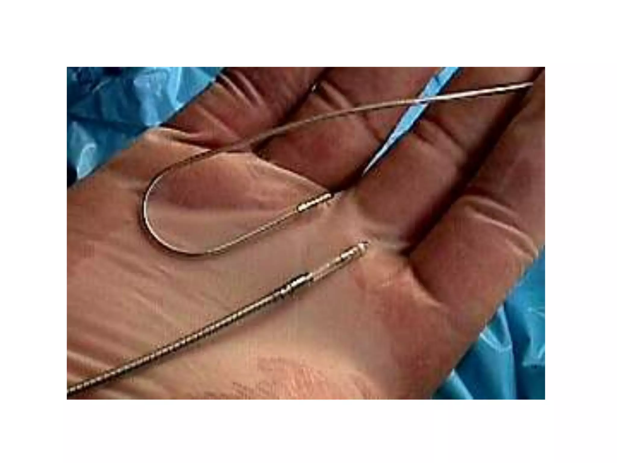 Temporary cardiac pacing | PPTX