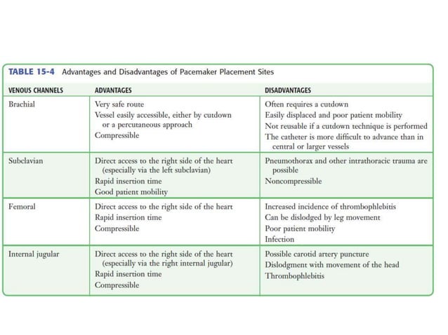 Temporary cardiac pacing | PPTX