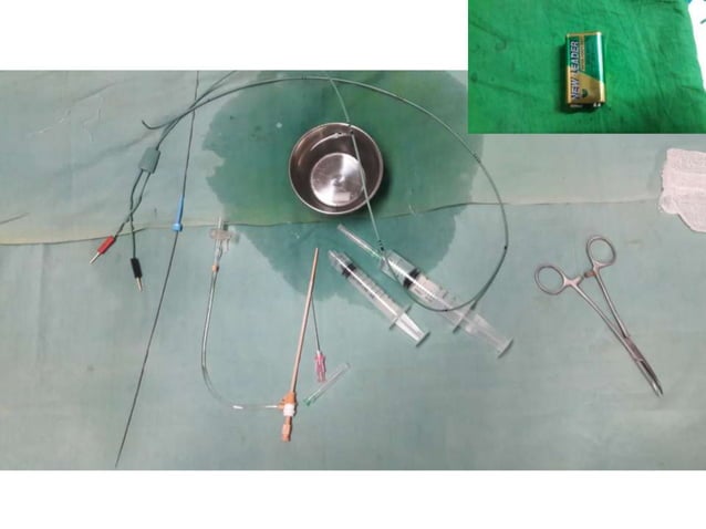 Temporary cardiac pacing | PPTX