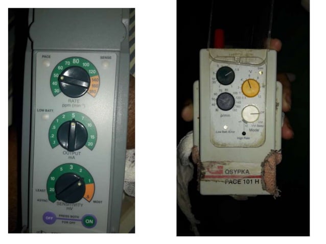 Temporary cardiac pacing | PPTX
