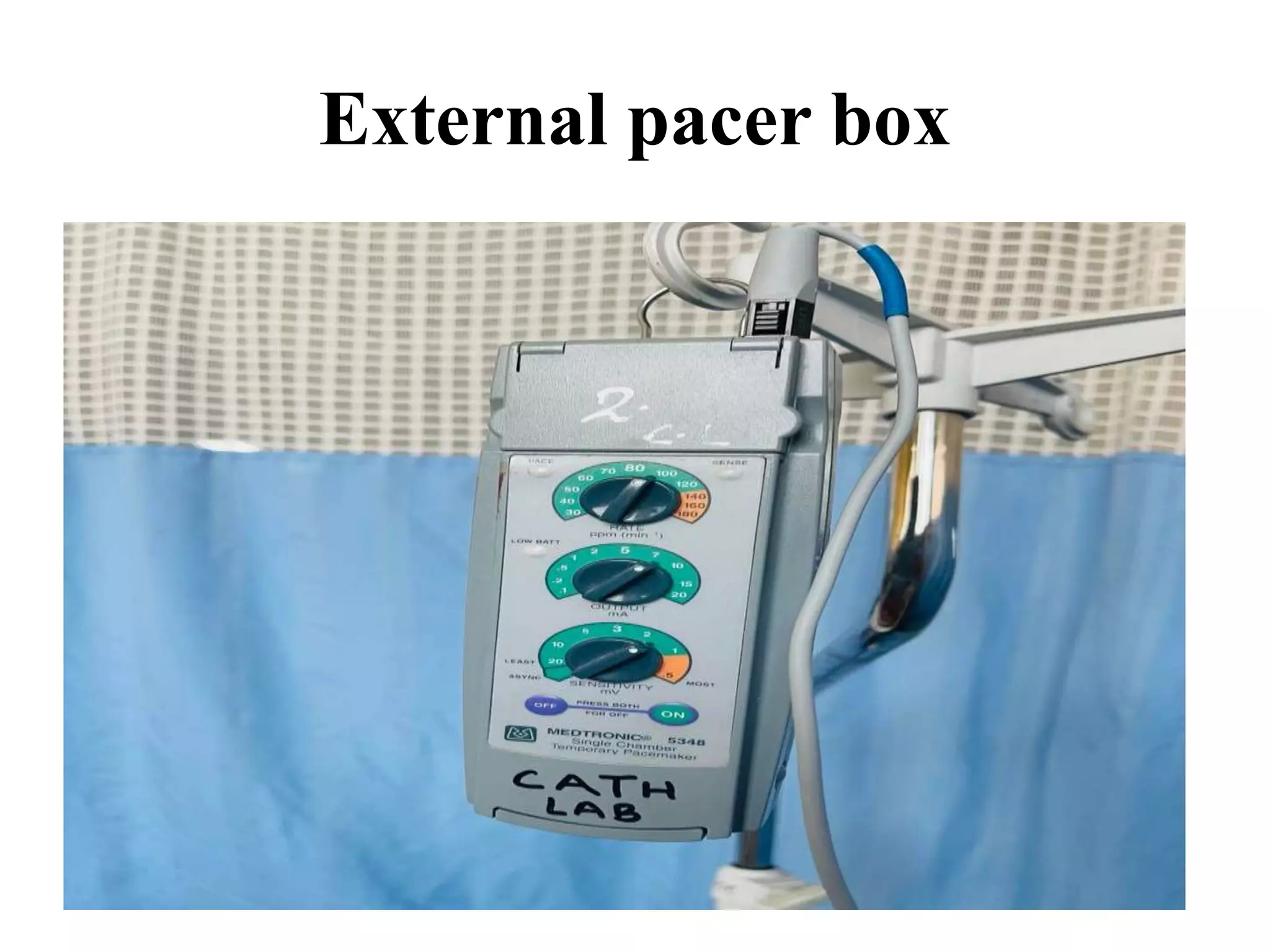Temporary cardiac pacing | PPTX