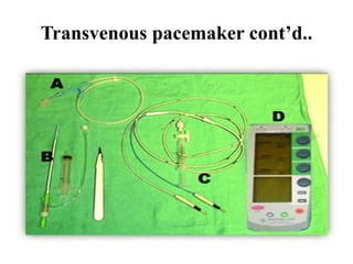 Temporary cardiac pacing | PPTX