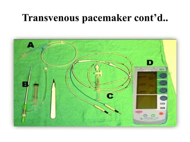 Temporary cardiac pacing | PPTX | First Aid | Injuries