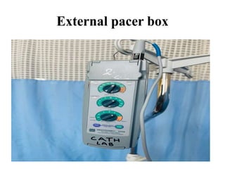 Temporary cardiac pacing | PPTX