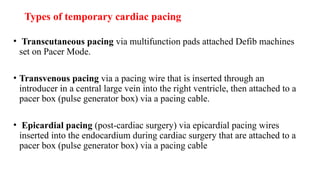 temporary epicardial pacing in cardiac surgery.pptx