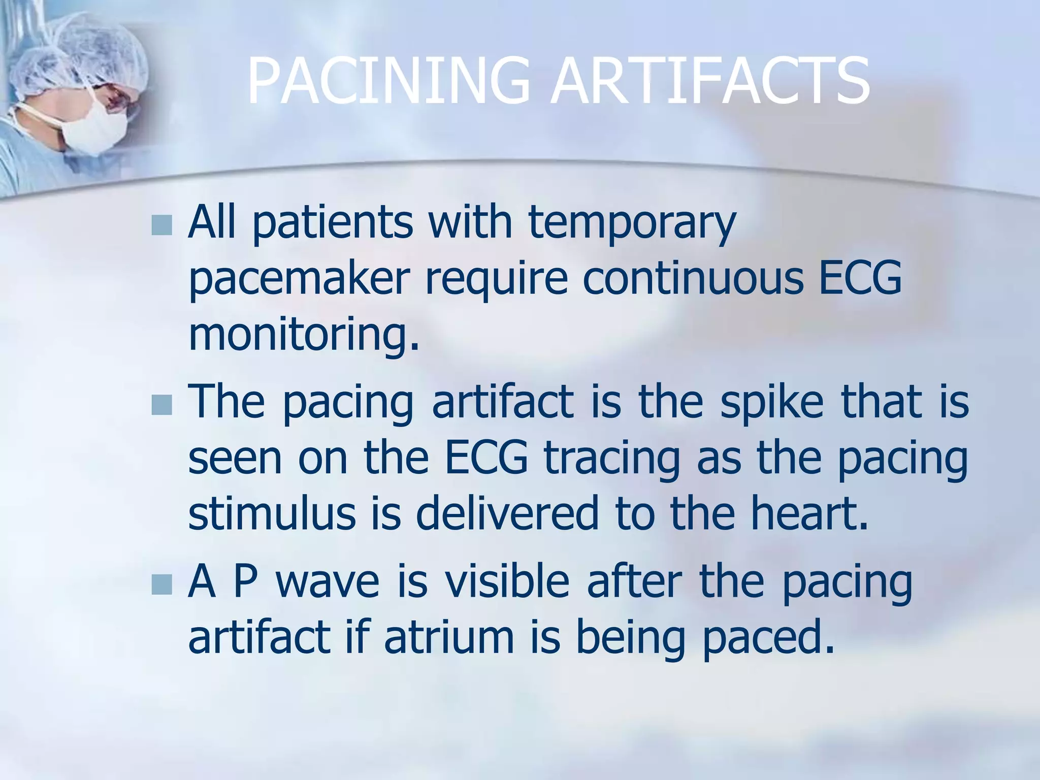 Temporary Pacemaker.pptx
