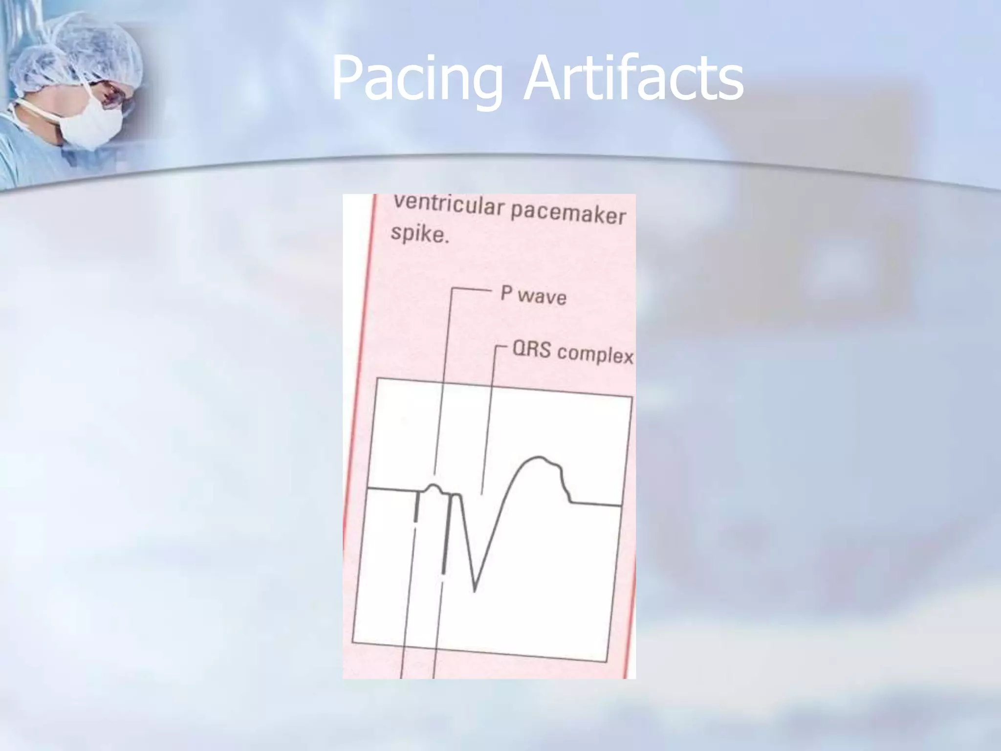 Temporary Pacemaker.pptx