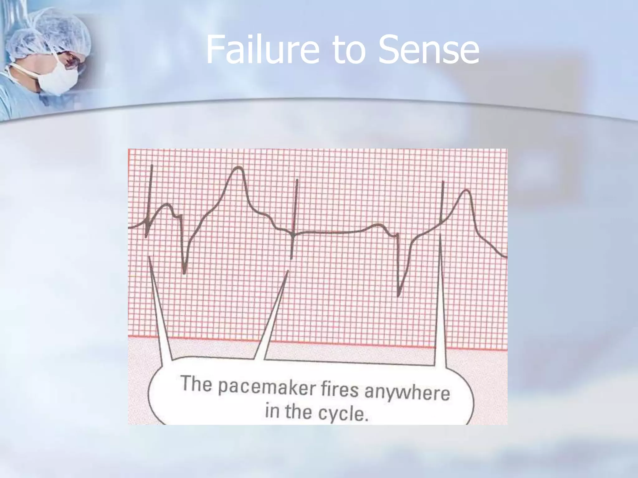Temporary Pacemaker.pptx