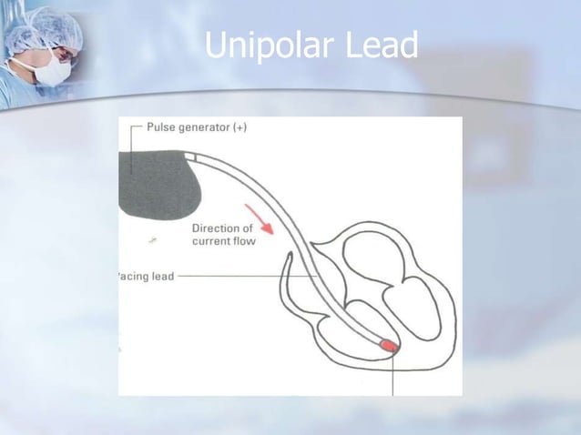 Temporary Pacemaker.pptx | Heart and Cardiovascular Diseases | Diseases ...