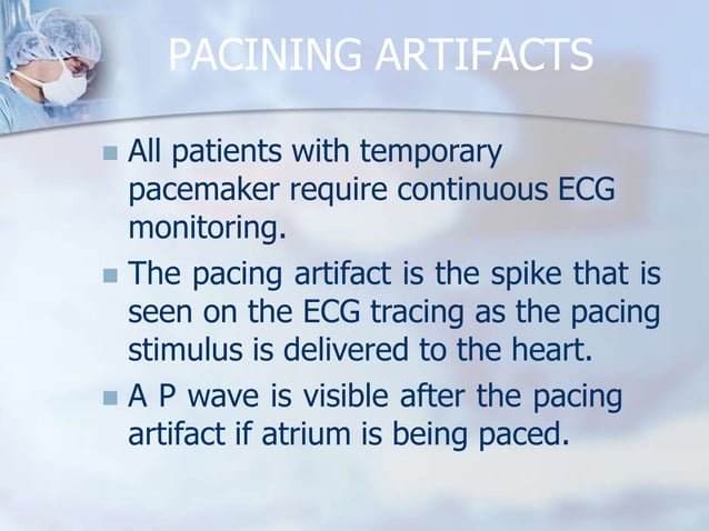 Temporary Pacemaker.pptx | Heart and Cardiovascular Diseases | Diseases and Conditions