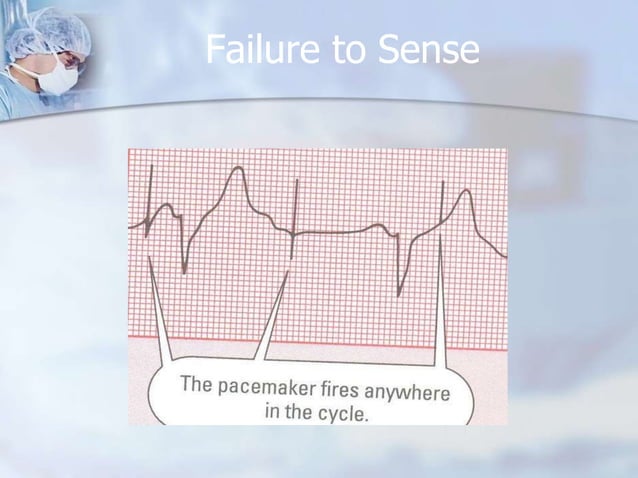 Temporary Pacemaker.pptx | Heart and Cardiovascular Diseases | Diseases ...