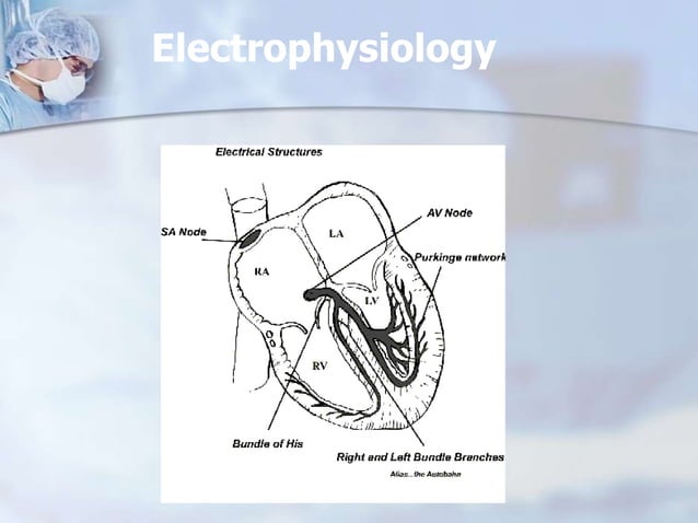 Temporary Pacemaker.pptx | Heart and Cardiovascular Diseases | Diseases and Conditions