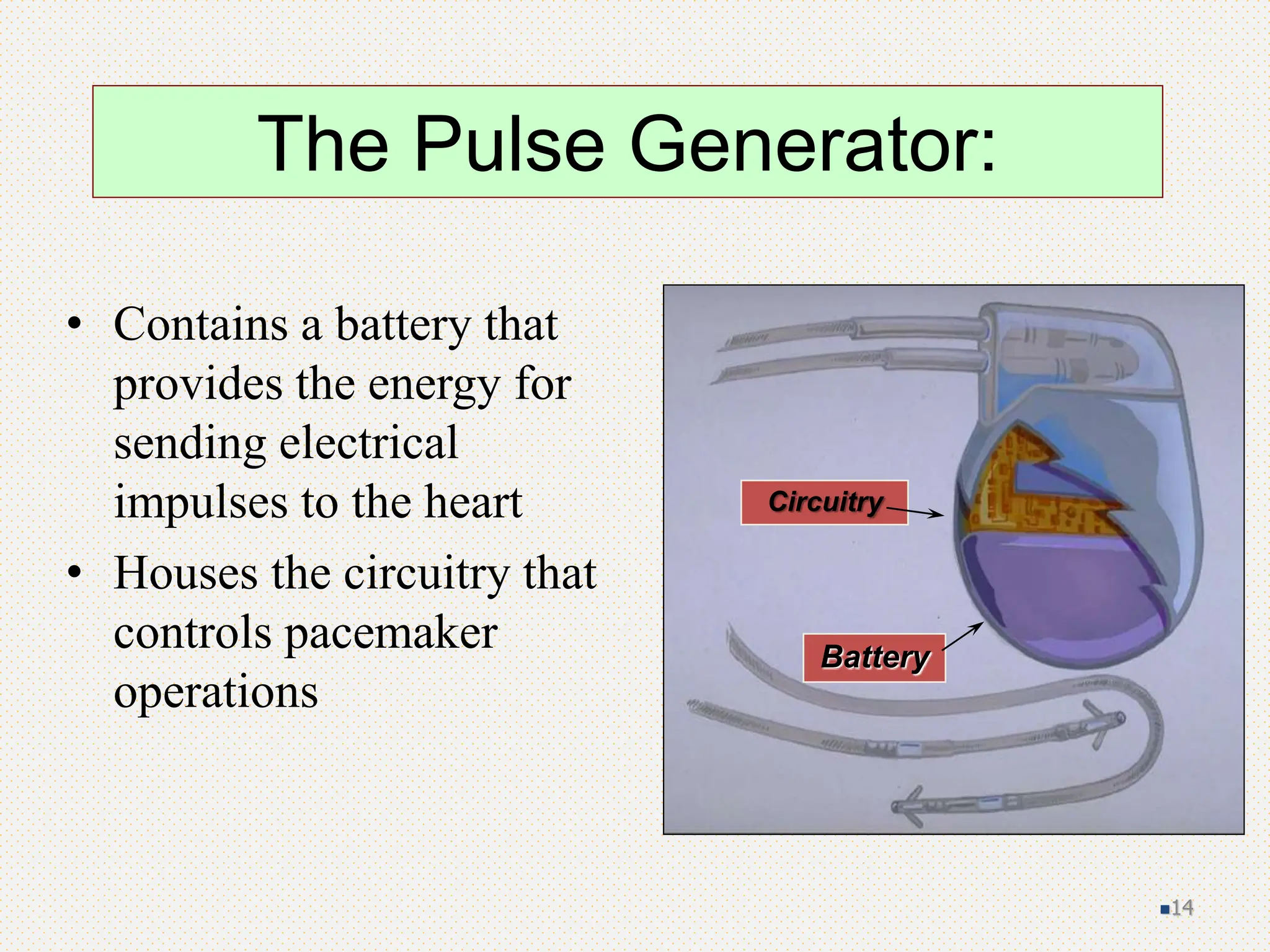temporary pacemaker easy to learn for PICU | PPTX