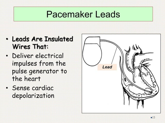 temporary pacemaker easy to learn for PICU | PPT