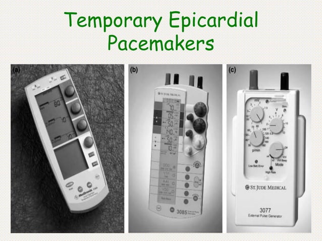 temporary pacemaker easy to learn for PICU | PPT