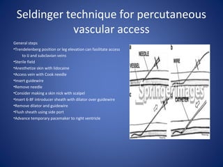 Pacemaker | PPT