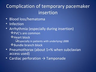 Pacemaker | PPT