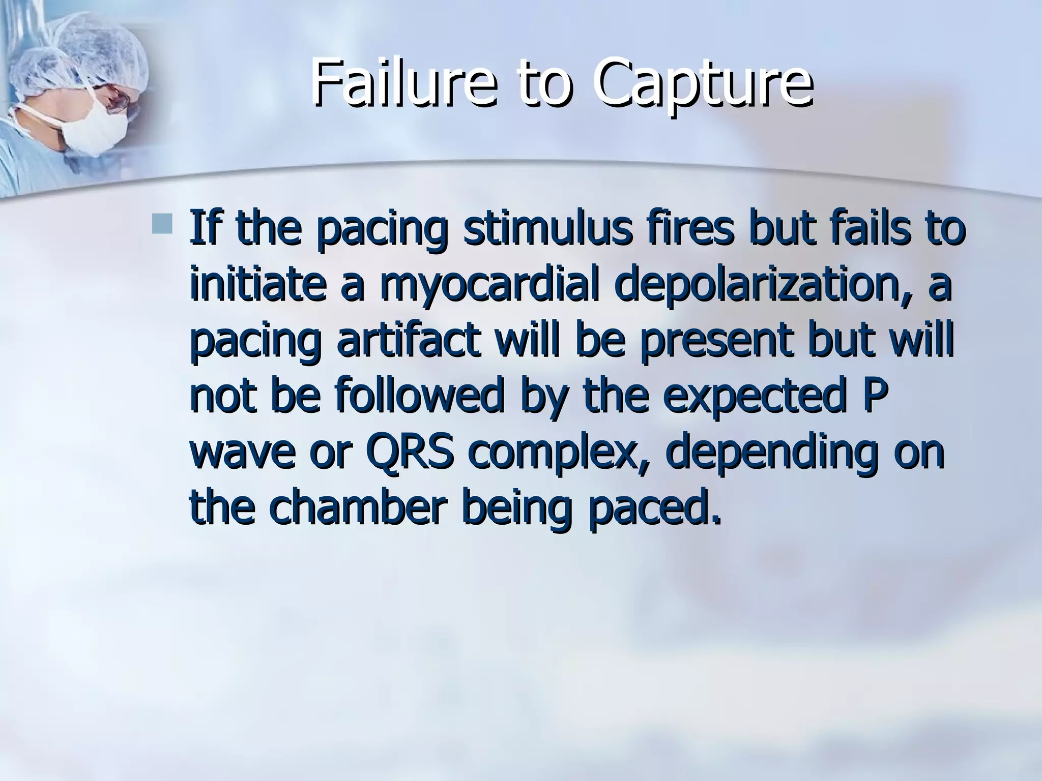 Temporary Pacemaker Slides | PPT