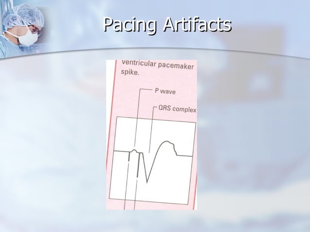 Temporary Pacemaker Slides | PPT | First Aid | Injuries