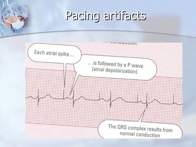 Temporary Pacemaker Slides | PPT | First Aid | Injuries