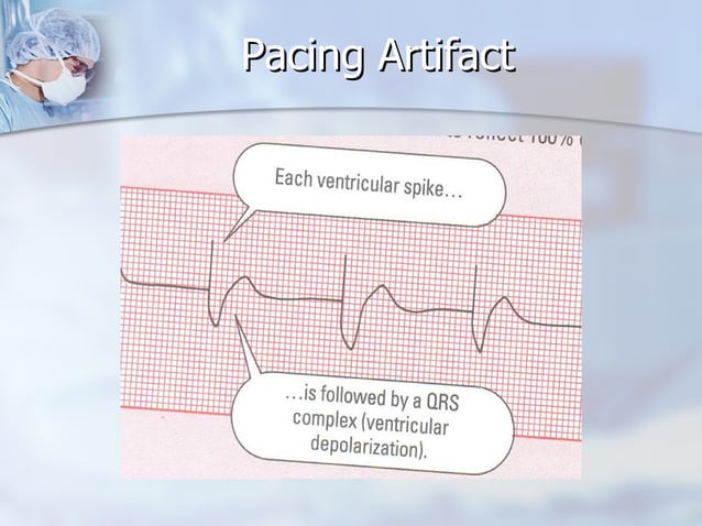 Temporary Pacemaker Slides | PPT | First Aid | Injuries
