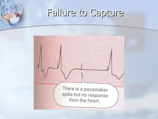 Temporary Pacemaker Slides | PPT | First Aid | Injuries