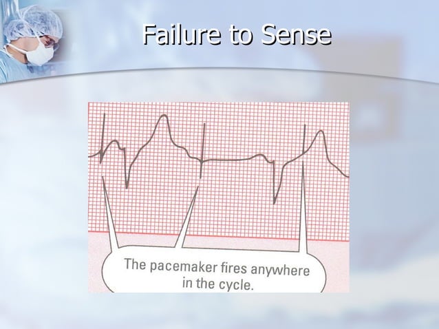 Temporary Pacemaker Slides | PPT | First Aid | Injuries