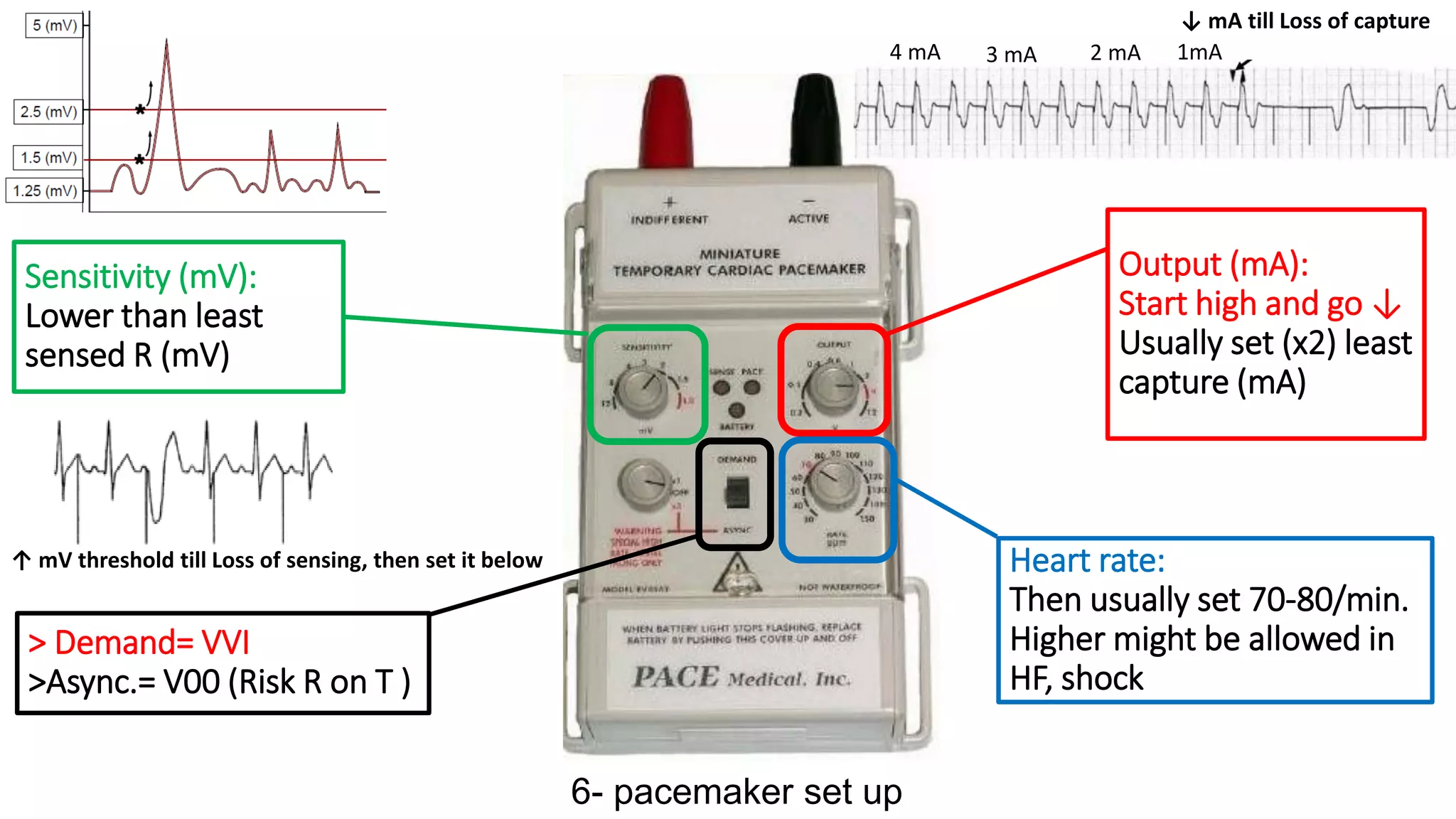 Temporary pacemaker | PDF