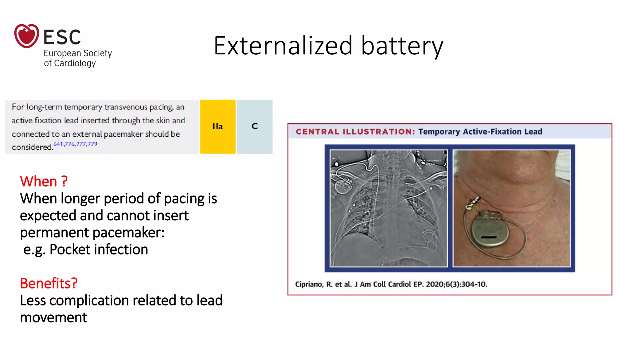 Temporary pacemaker | PDF