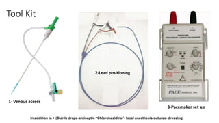 Temporary pacemaker | PDF