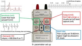 Temporary pacemaker | PPT