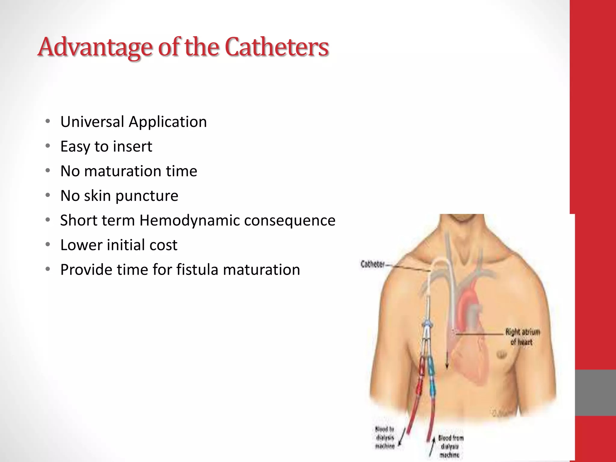 Temporary vascular access for hemodialysis | PPTX