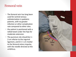 Temporary vascular access for hemodialysis | PPTX